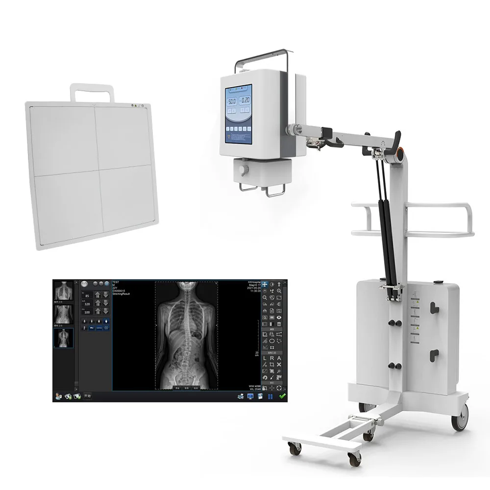 Iray DR Wireless Flat Panel Detector - Medical X-Ray Equipment