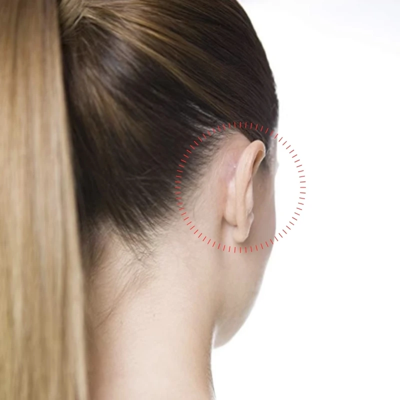 Wholesale Silicone Ear Corrector - Instant Ear Correction