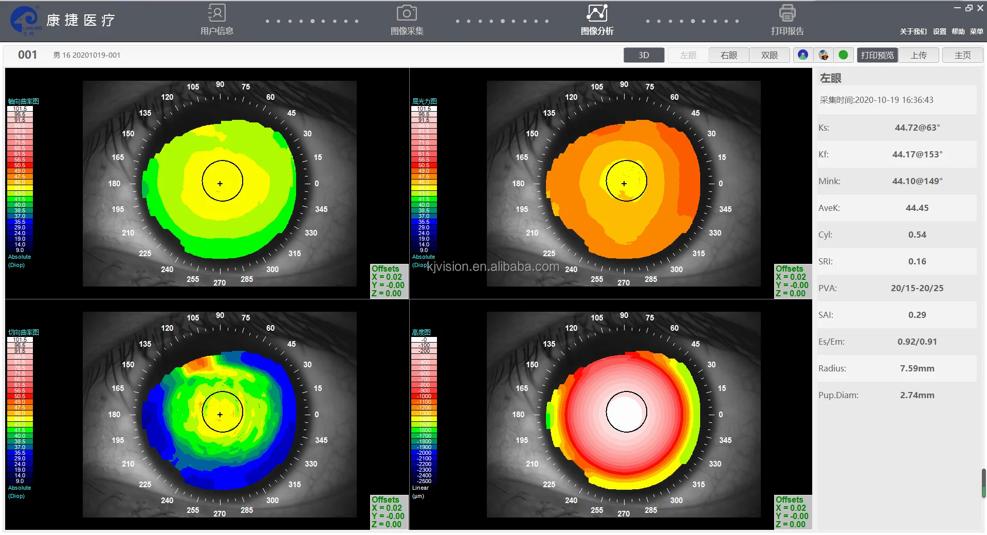 Accurate Corneal Topographer Map System - KJ30 by Kangjie