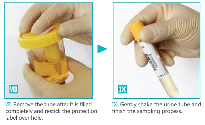 Medical Use Specimen Container 120ml - Urine Collection Cup
