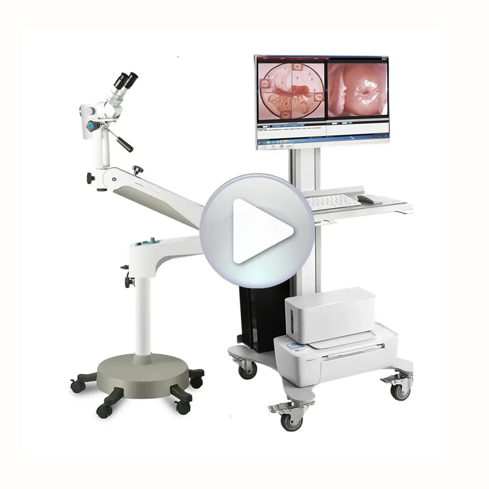 Kernel Optical Colposcope Alscope Optical Binocular Colposcope 2100000 ...