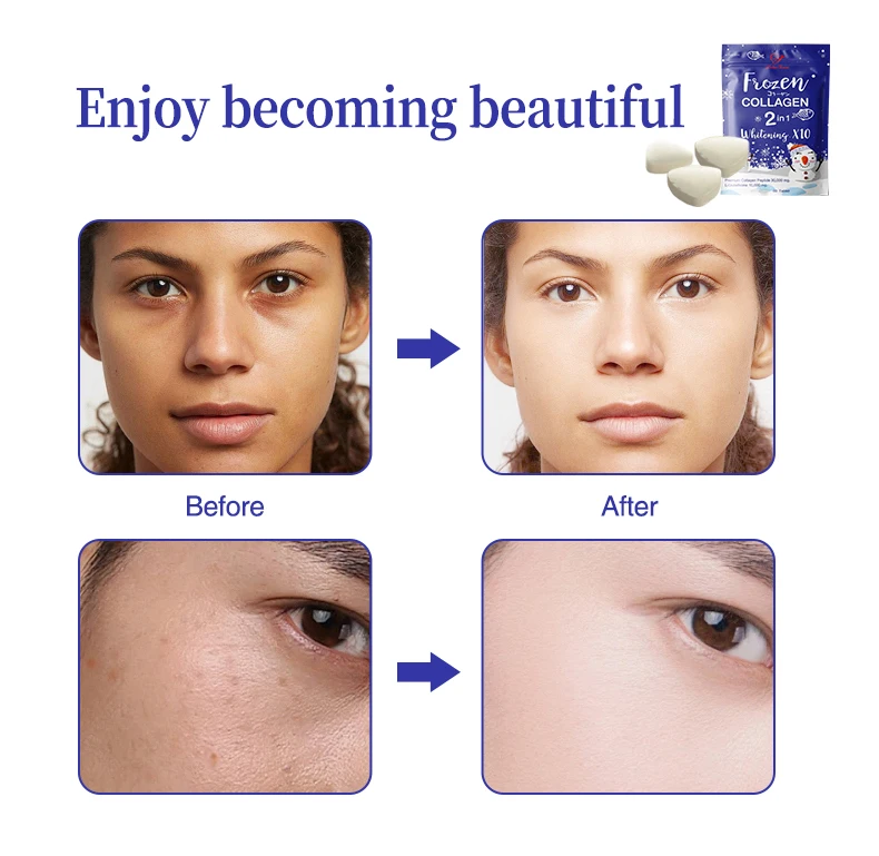 Snow White Skin Protect Skin Anti-aging Whitening Wrinkle Reducing L ...