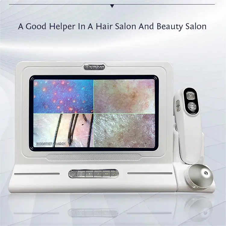 Scanner to See Hair Follicle Hair Follicle Scalp Scanner Hair Analysis ...