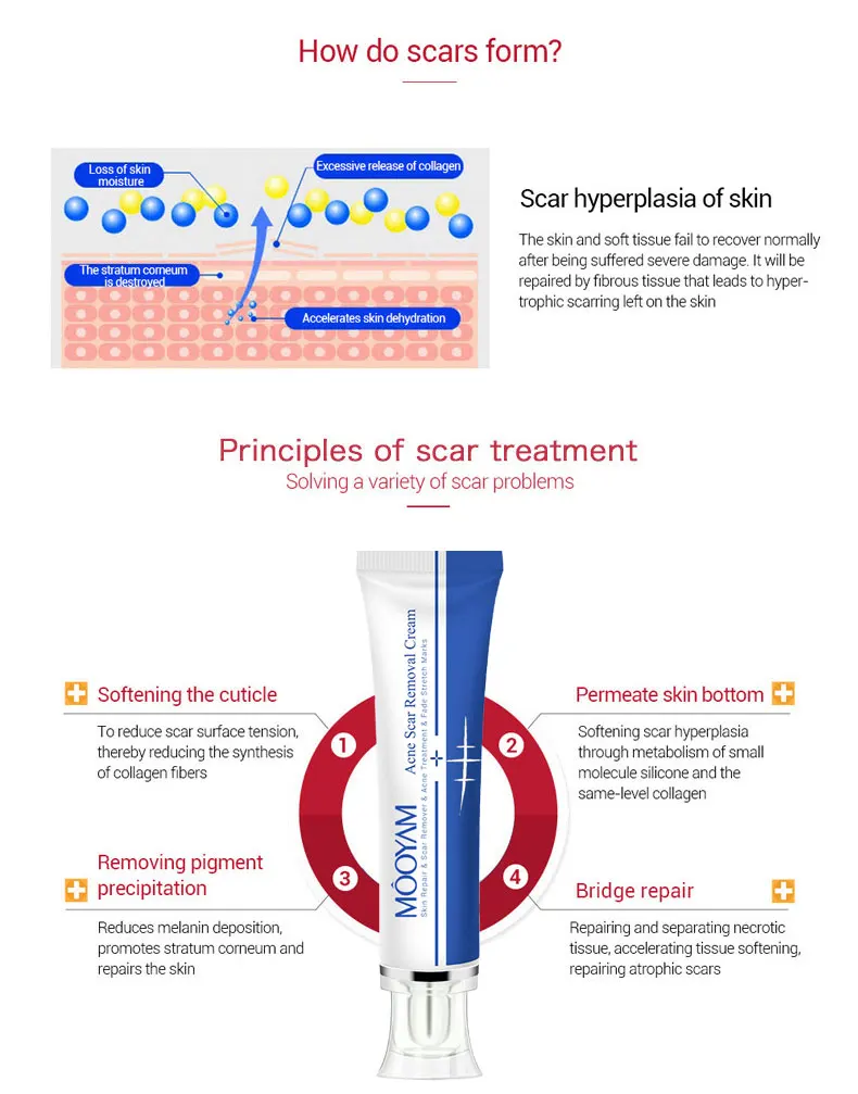 Strong Effective Acne Scar Removal Pimples Stretch Marks Remove Face ...