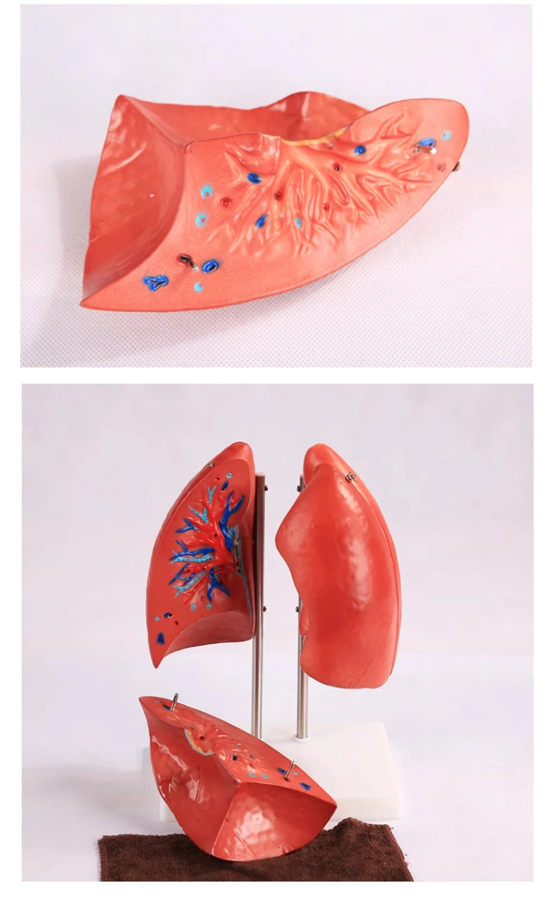 Detachable Human Anatomy Lung Anatomical Model - Buy Lung Anatomical ...