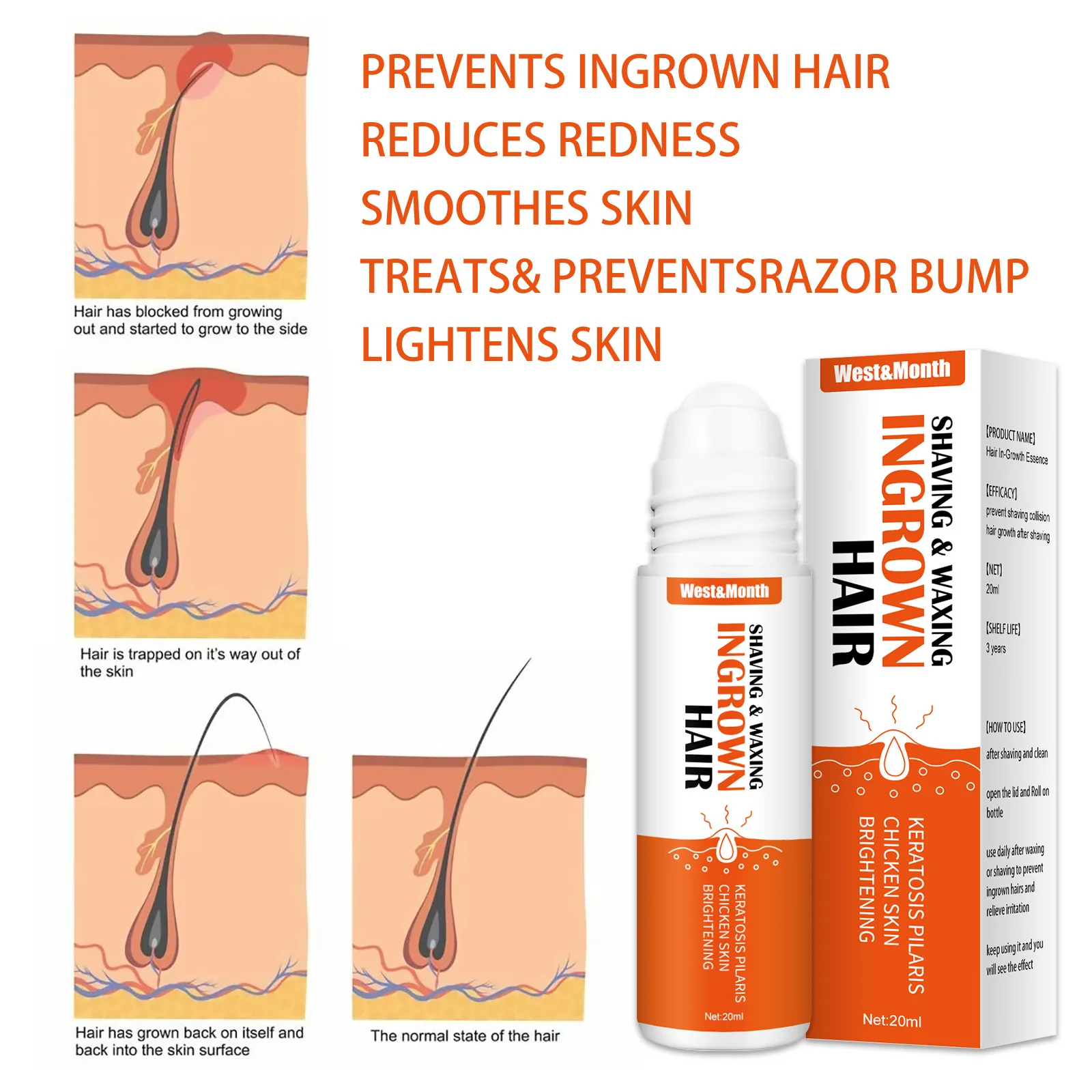 West & Month Ingrown Hair Cream Bump Removal Stopper Treatment Prevent ...