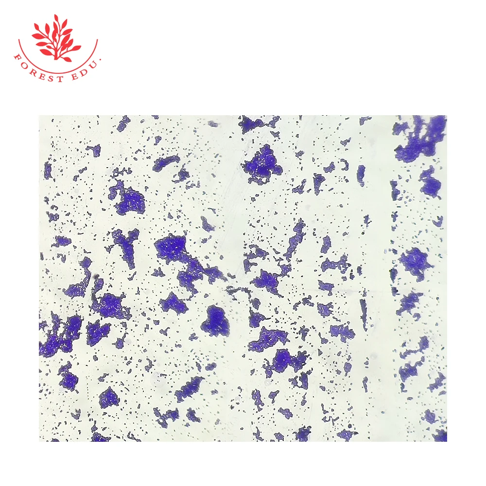 Medical Science Microorganism Microscope Slides Microbiology ...