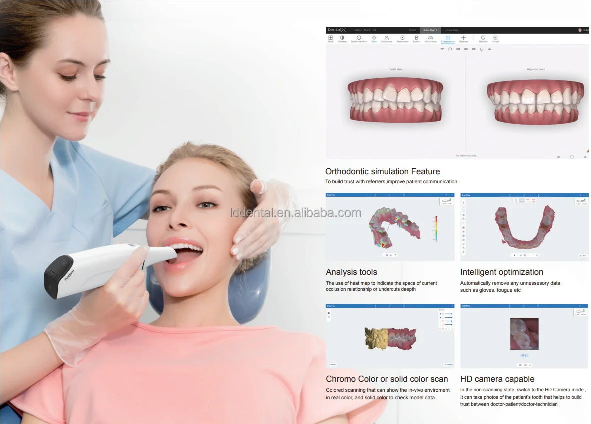 福森s7000无线3d数字口内扫描仪系统 - Buy Fussen S7000口内无线扫描仪,无线口内牙科扫描仪经销商价格:,口内3d无线扫描 ...