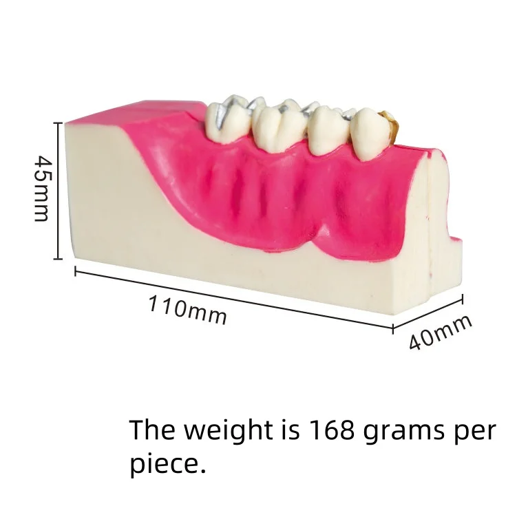 Wisdom Tooth Tissue Disassembly Model Right Lower Posterior Teeth Oral ...