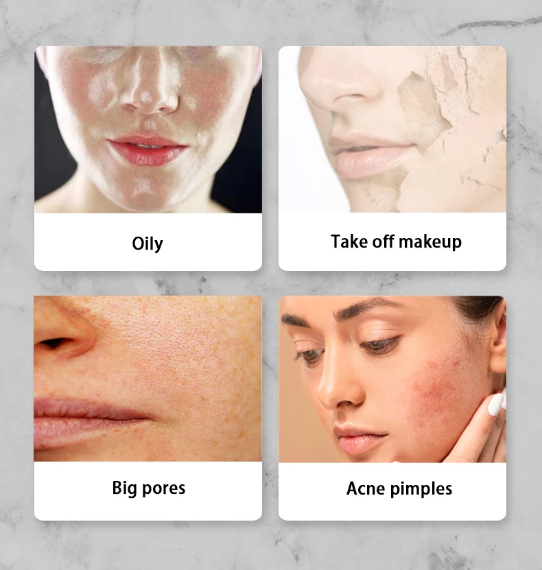 Summer Skincare Tool Washable Oil-control Facial Oil Absorbing Roller ...