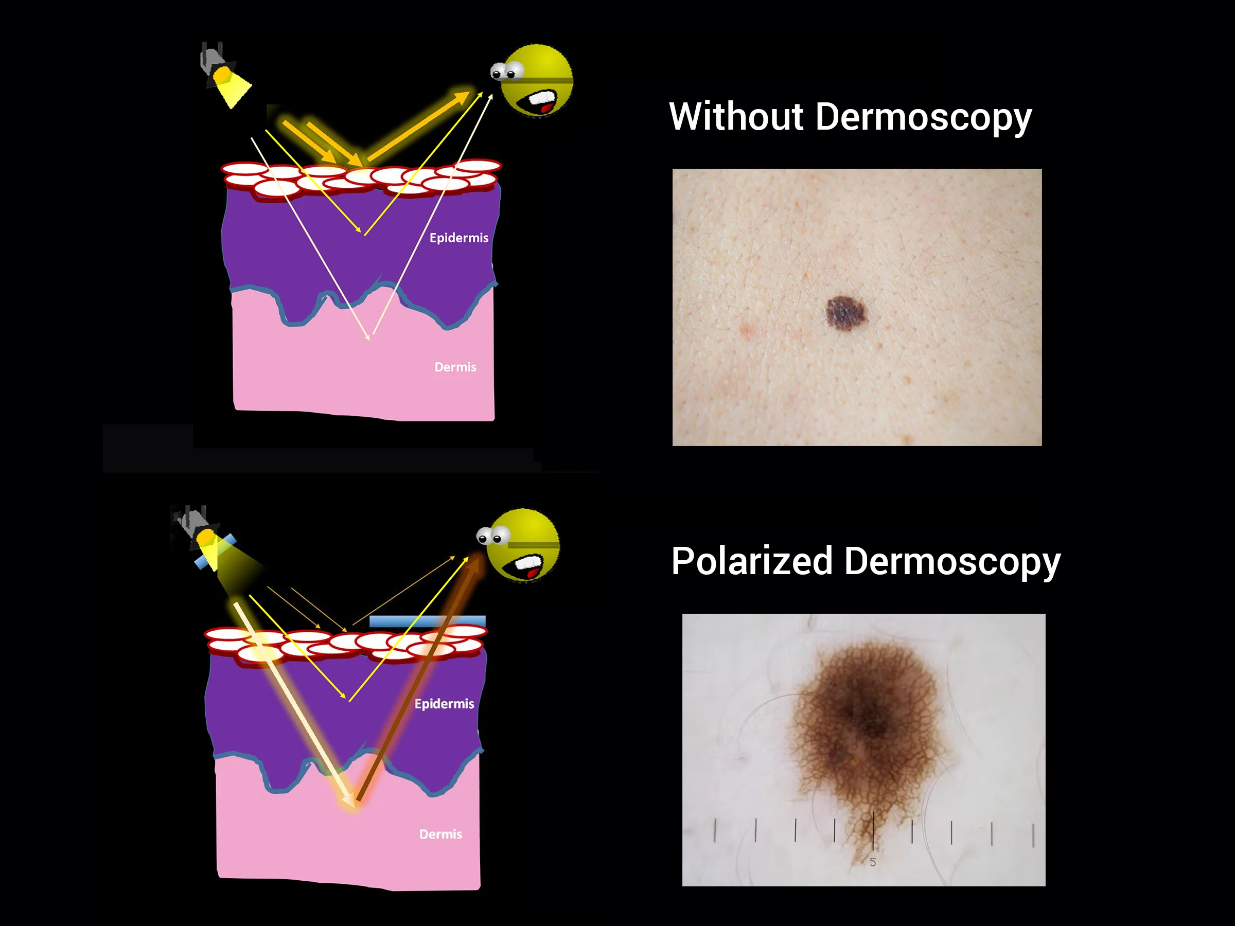 IBOOLO DE-400 Smartphone Polarized Dermatoscope - 10X Magnification