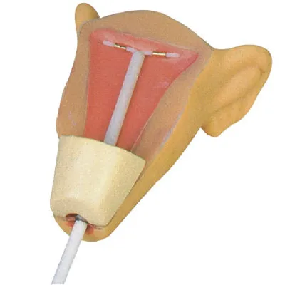IUD Training Simulator - Educational Model for Medical Schools