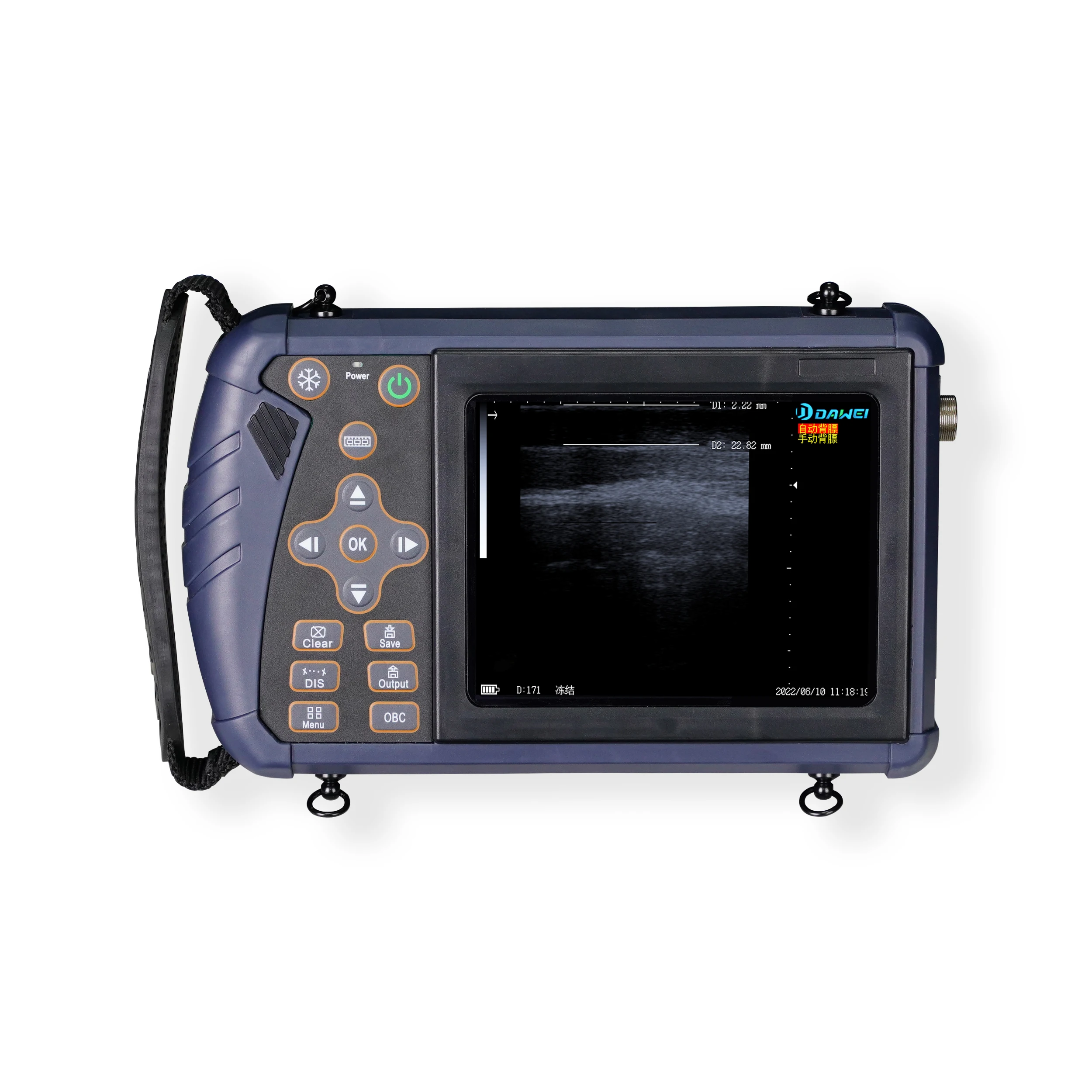 Daweivet Animal Ultrasound Scanner - Portable & Versatile