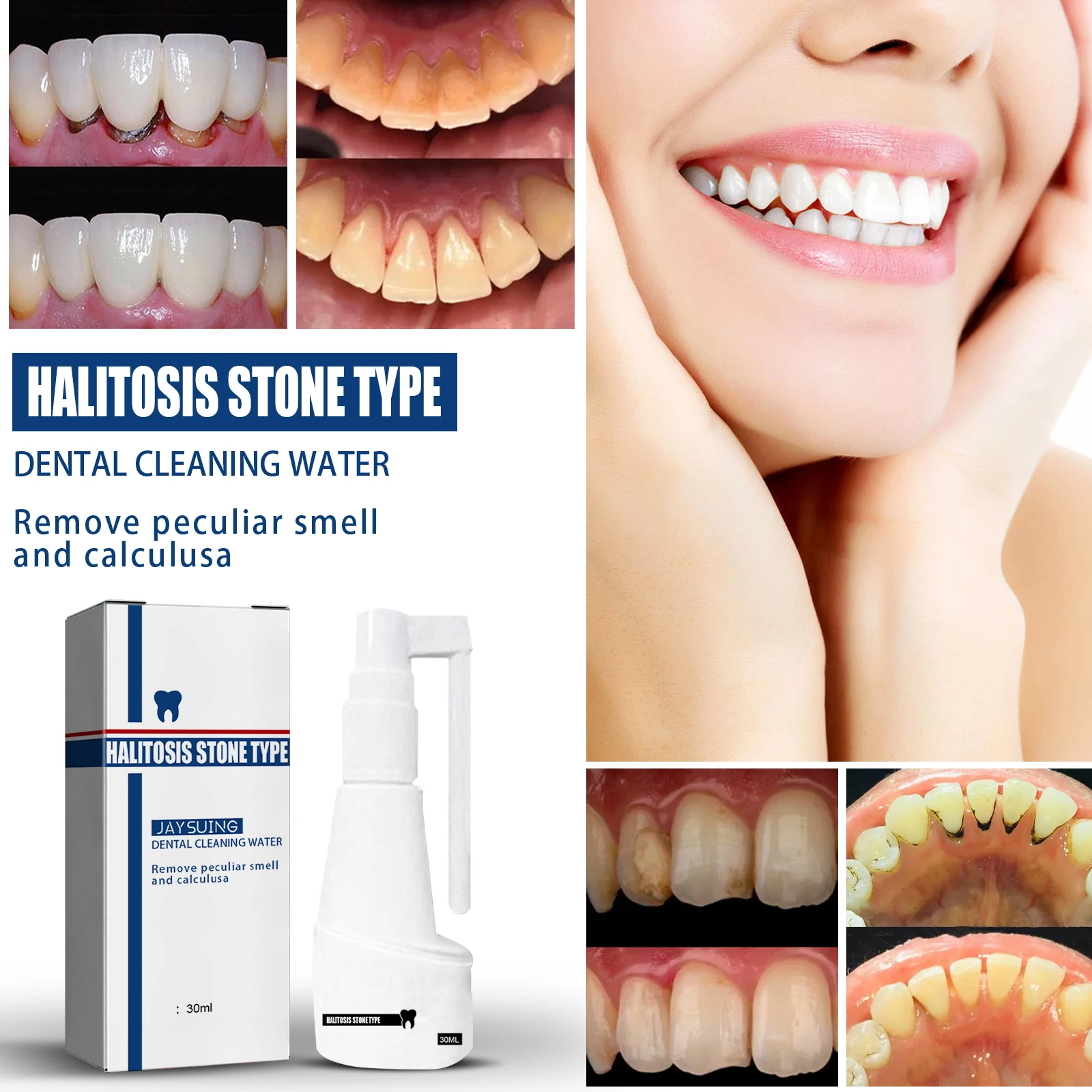 Dental Calculus Dissolving Oral Spray - Eliminate Halitosis