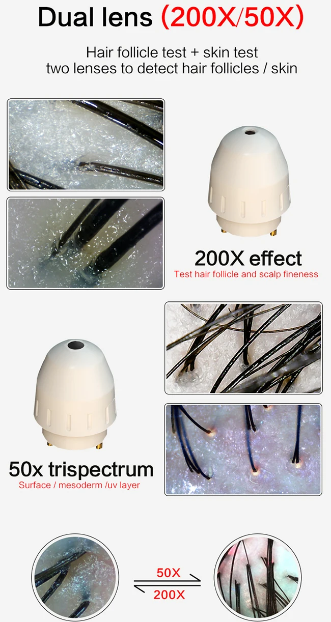 Sa-s04a Portable Skin Tester Wrinkle Analysis Hair Analyzer Scalp ...