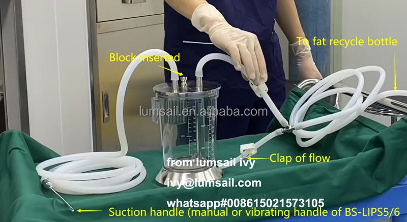 Lipo Filter Jar Fat Collection Canister for Med Spa/Facelift/Eyelid ...