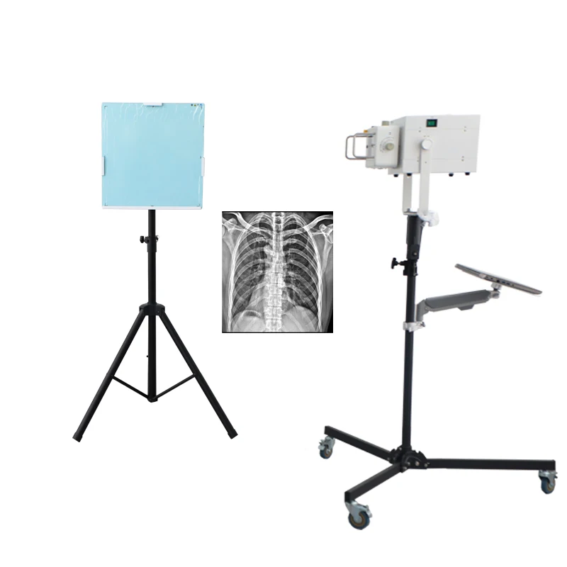 mobile x ray machine clinic chest X-ray machine portable x-ray machine ...