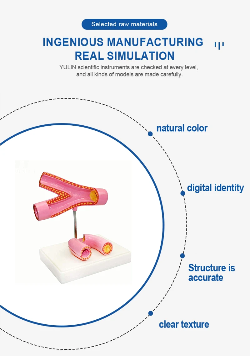 Anatomical Human Blood Vessel Model Arteriosclerosis Model With ...