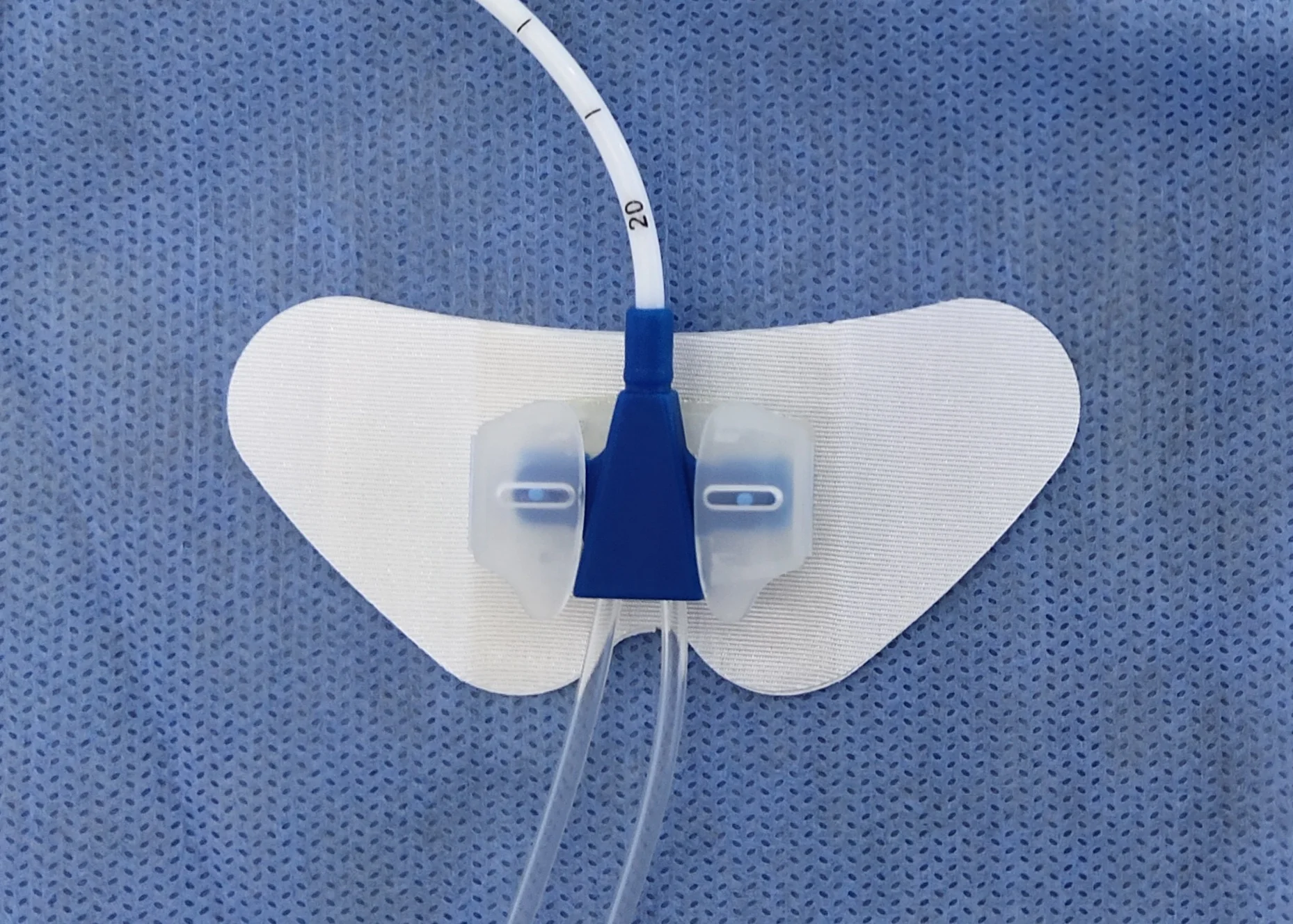 Customized Securement Lock-transparent Dressing And Catheter Fixator ...