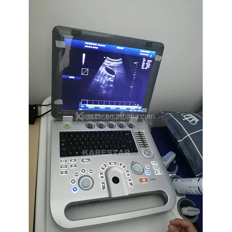 Echocardiography Machine Price 3d 4d Cardiac Echo Karestar Portable CW ...