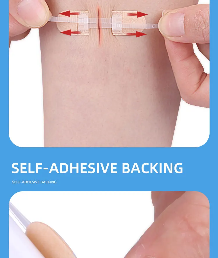 Wound Closure Strips - Secure Wound Closure System