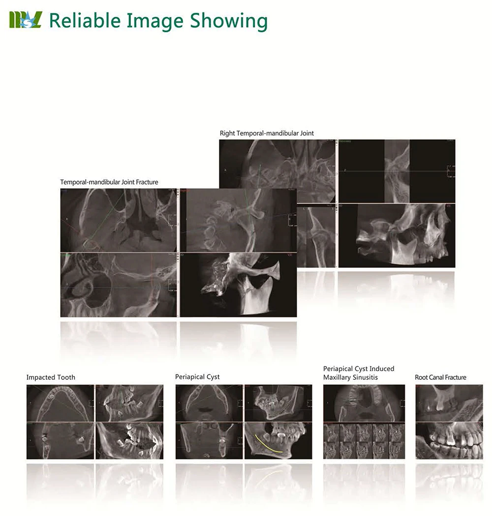 Dental Instruments - MSLDX20 Digital CBCT 3D OPG X Ray Scanner