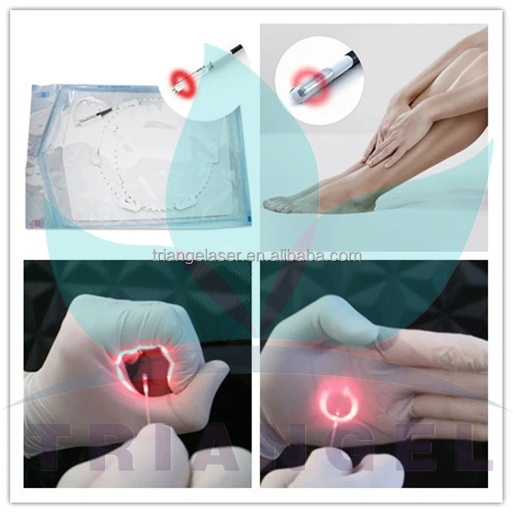 SMA905 Radial/tip/bare Fibers for Medical Surgery Lasers