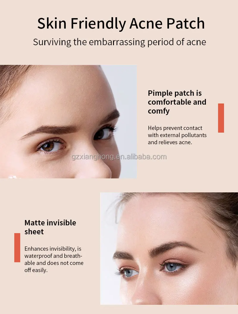 72 Hydrocolloid Acne Absorbing Spot Dot Mighty Patch Facial Acne ...