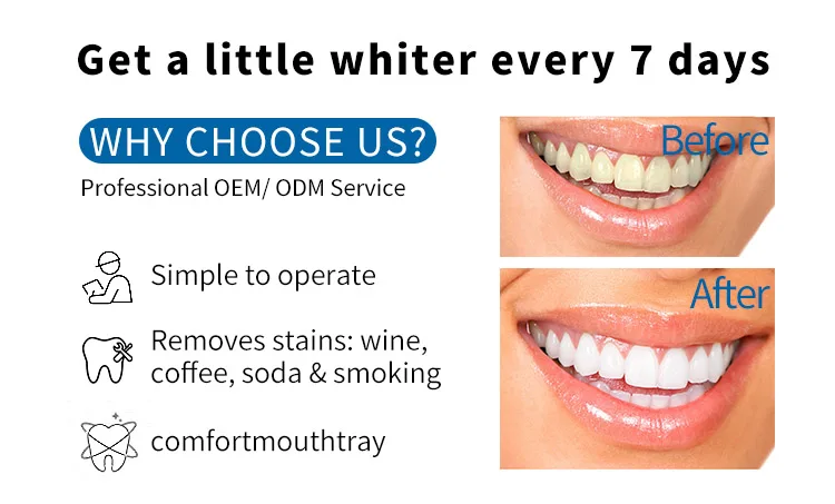Dental Bleaching Non Peroxide Private Logo Blue Light Led Teeth ...