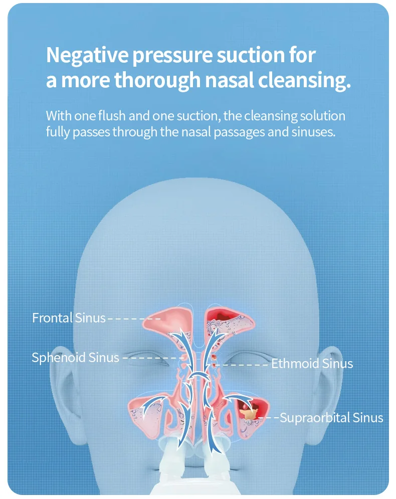 Top Rated Best Deals On Sinus Navage With The Lowest Prices Nasal Wash ...