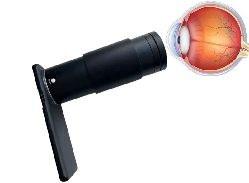 Digital Handheld Portable Retinal Camera for Eye Fundus