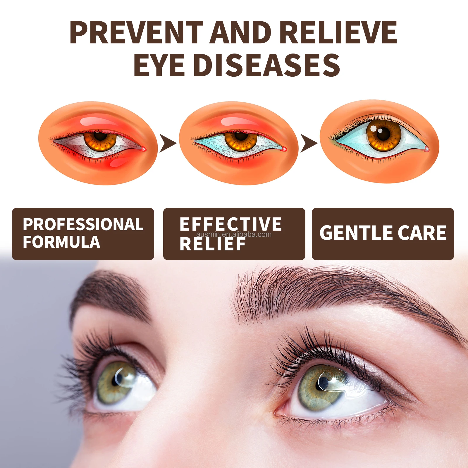 New Arrivals Ultra Eye Lubricant Spray Soothe Eyes Diseases Remove Red ...
