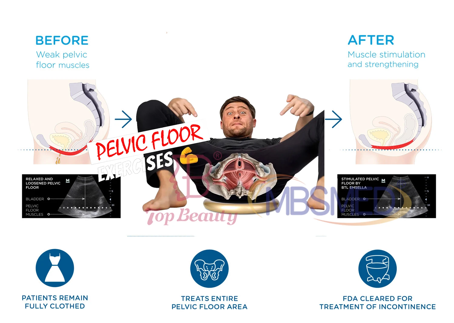 Electrostimulation Pelvic Muscle Trainer Butt Lifting Tools Pelvic ...