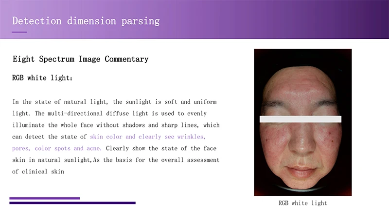 Professional Facial 3D Skin Analyzer Facial Scanner for Dermatology ...