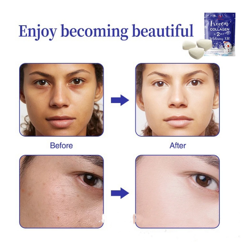 Frozen Collagen Detox Skin Whitening Capsules Frozen Collagen 2 In 1 ...