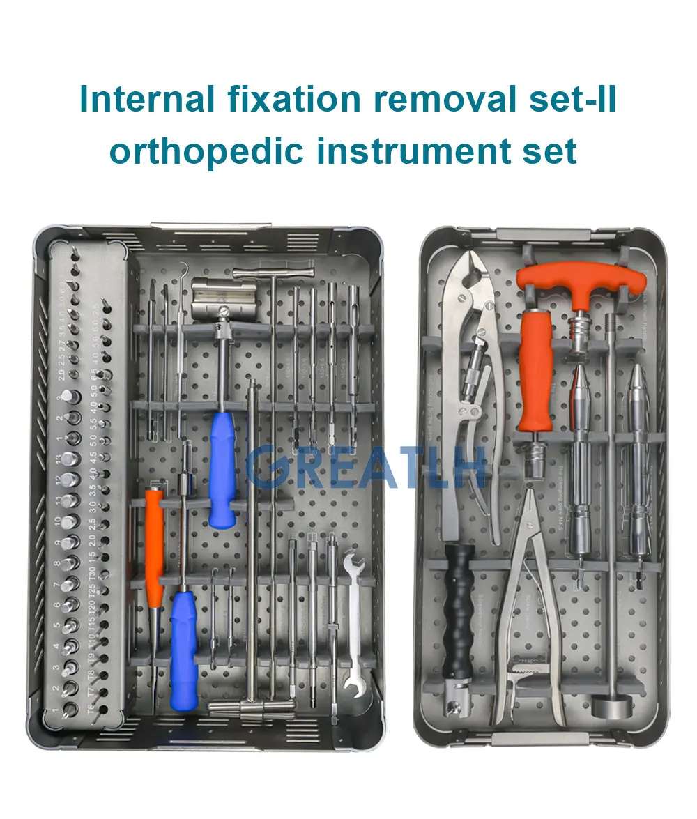 Surgical Instrument Orthopedic Implants Nails Broken Interlocking Nail ...