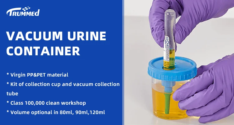 Medical Use Specimen Container 120ml - Urine Collection Cup