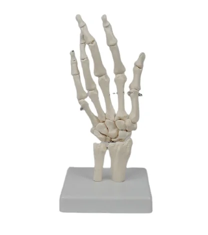Life Size Human Hand Joint Anatomy Model Without Ligaments Wrist Joint ...