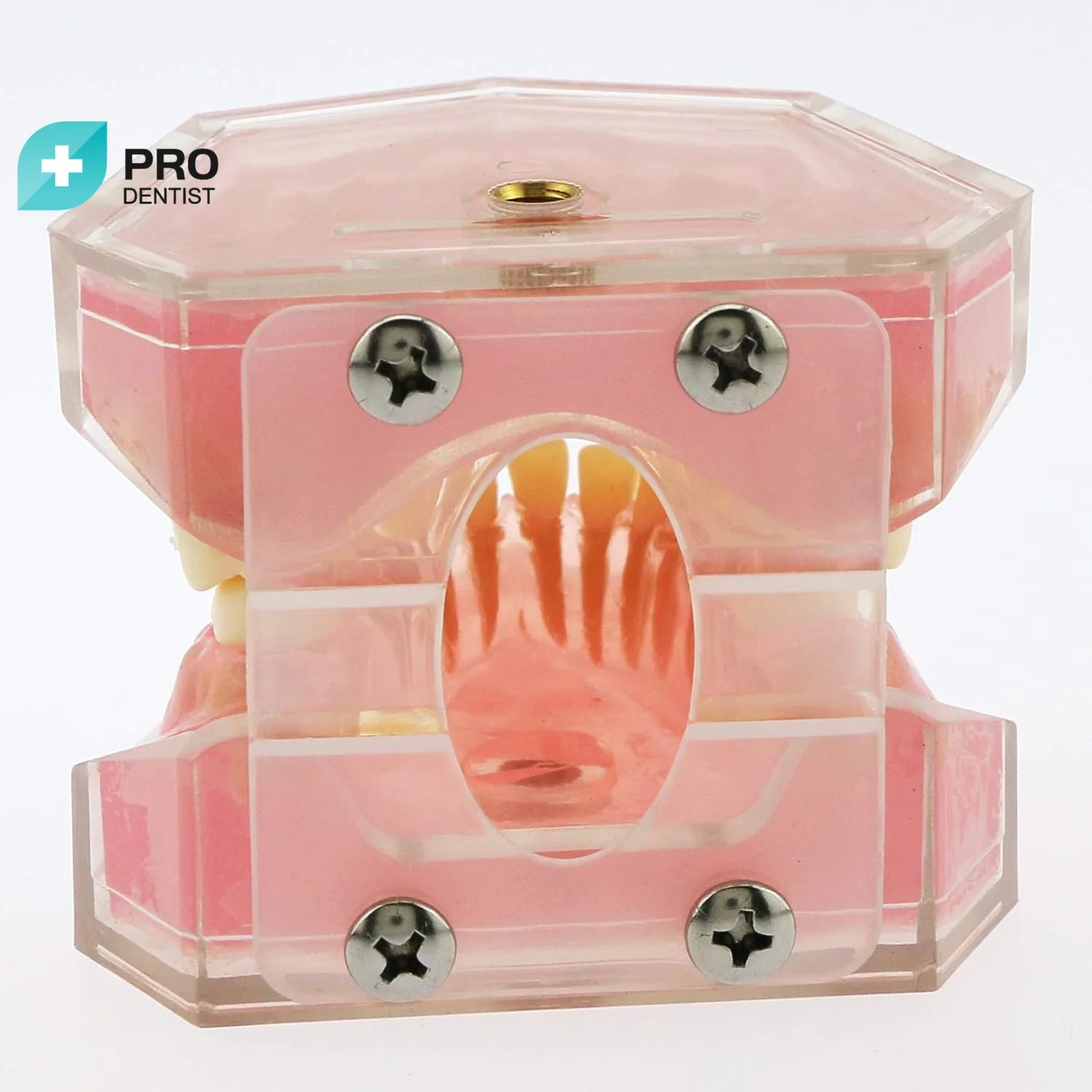 Orthodontic Typodonts Model - Gum Wax Embankment Teeth Practice Model ...