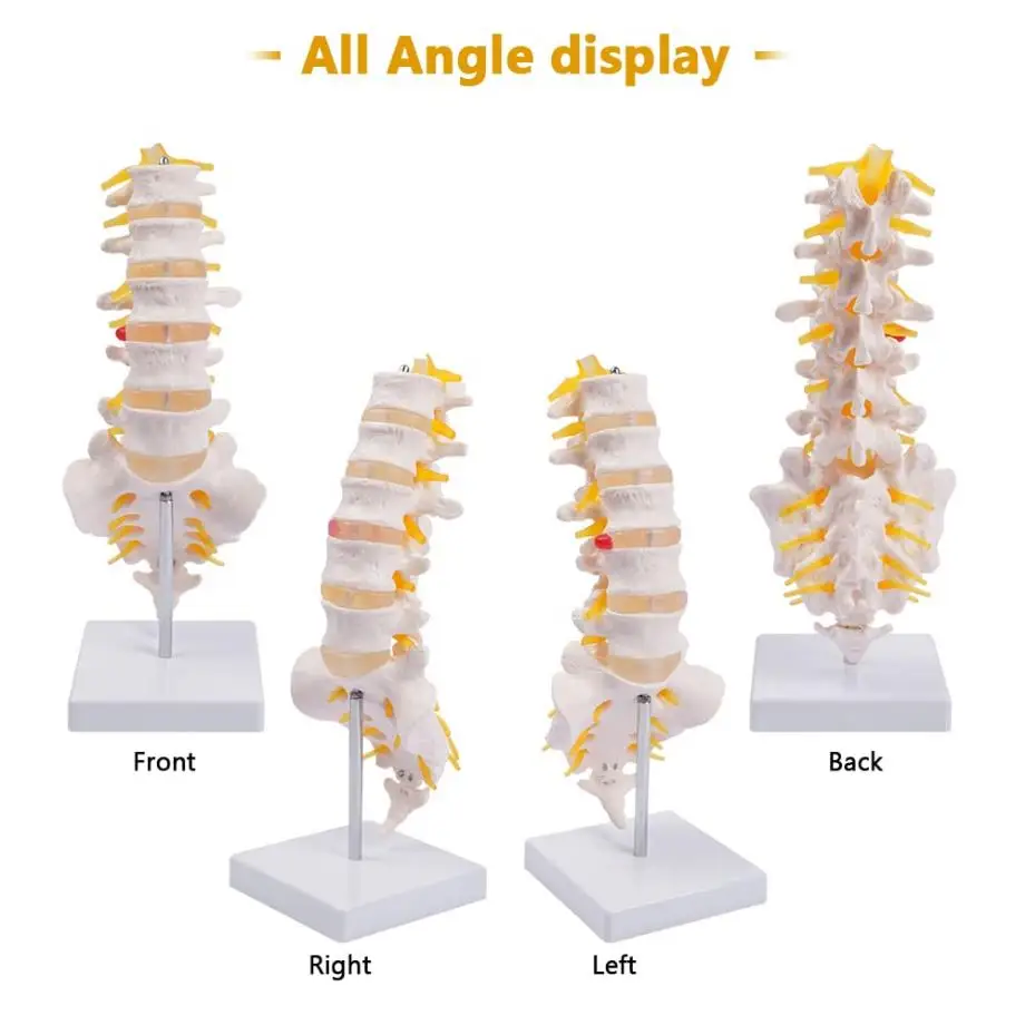 Medical Teaching Lumbar Vertebrae with Sacrum & Coccyx and Herniated ...