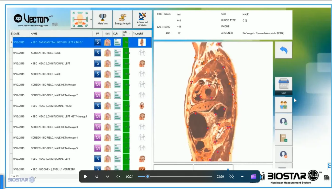 Portable Body Scanner - Biofeedback Health Analyzer