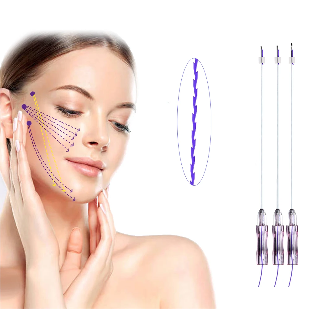 Stronger Lifting Face Hilos Thread Tensores Molding Cog Blunt W 18g ...