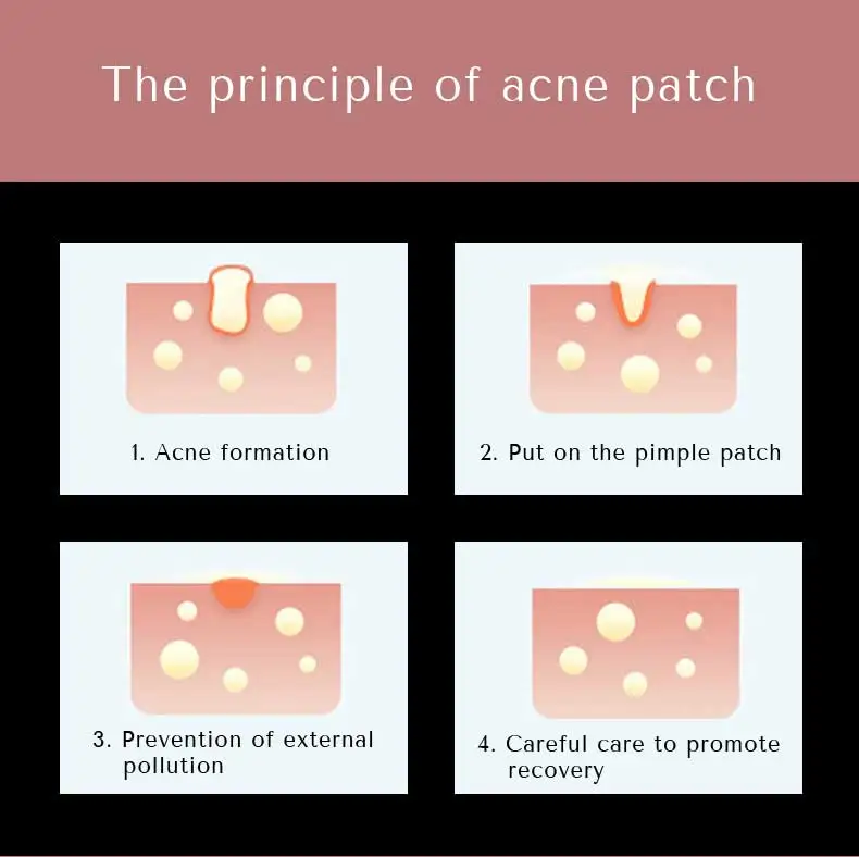 Korean Hydrocolloid Acne Pimple Patch - Effective Relief