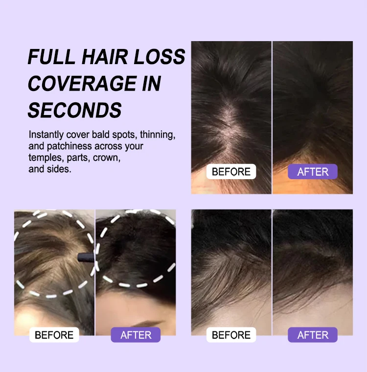 Sevich Patented Fiber Builder Sprinkler Hair Building Fiber Spray With ...