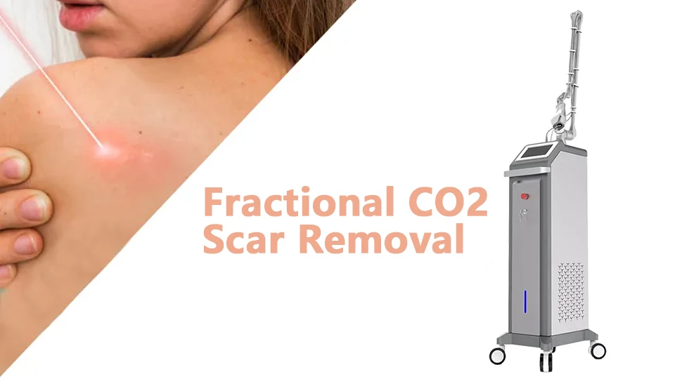 Svatar Cutting Warts Mole Nevus Vaginal Fractional Carbon Facial ...