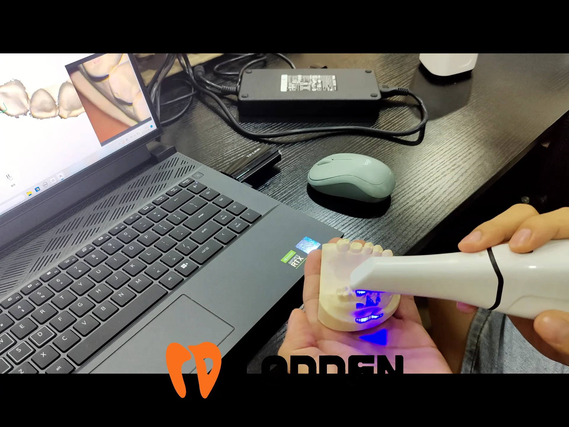 福森s7000无线3d数字口内扫描仪系统 - Buy Fussen S7000口内无线扫描仪,无线口内牙科扫描仪经销商价格:,口内3d无线扫描 ...