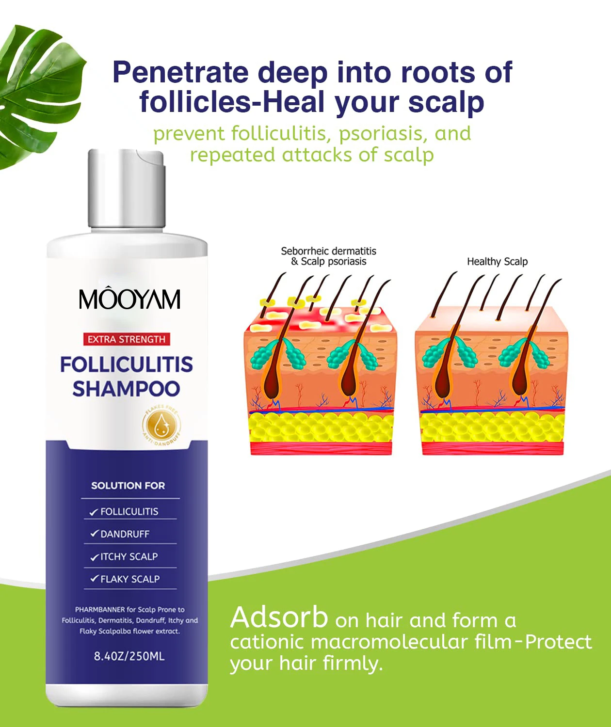 Customized Scalp Folliculitis Shampoo for Seborrheic Dermatitis ...