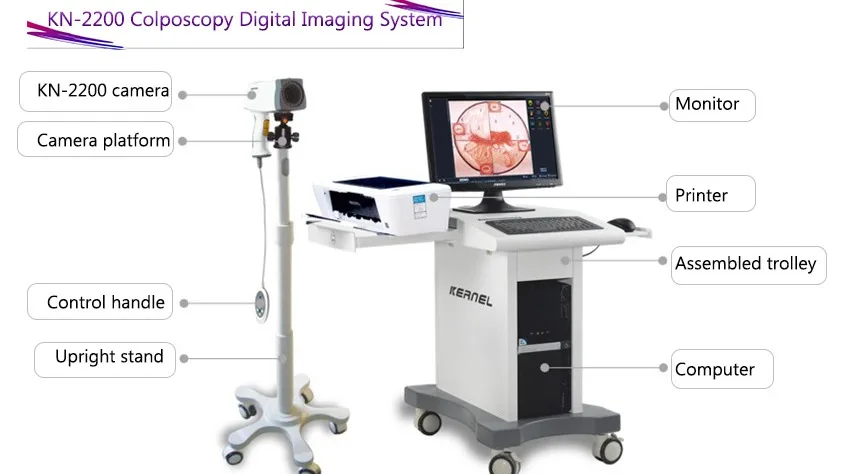 Kernel Kn-2200 Colposcopy Device Gynecology Colposcope For Diagnosis Of ...