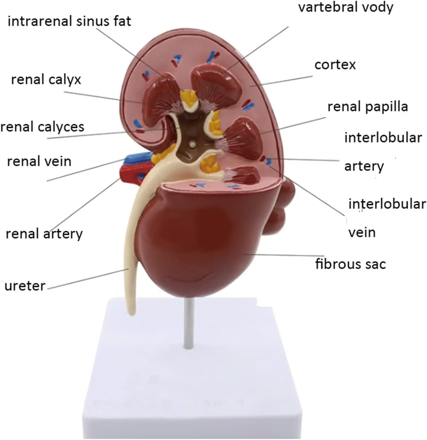 Pathology Kidney Model Dual Perspective With Normal And Diseased Kidney ...