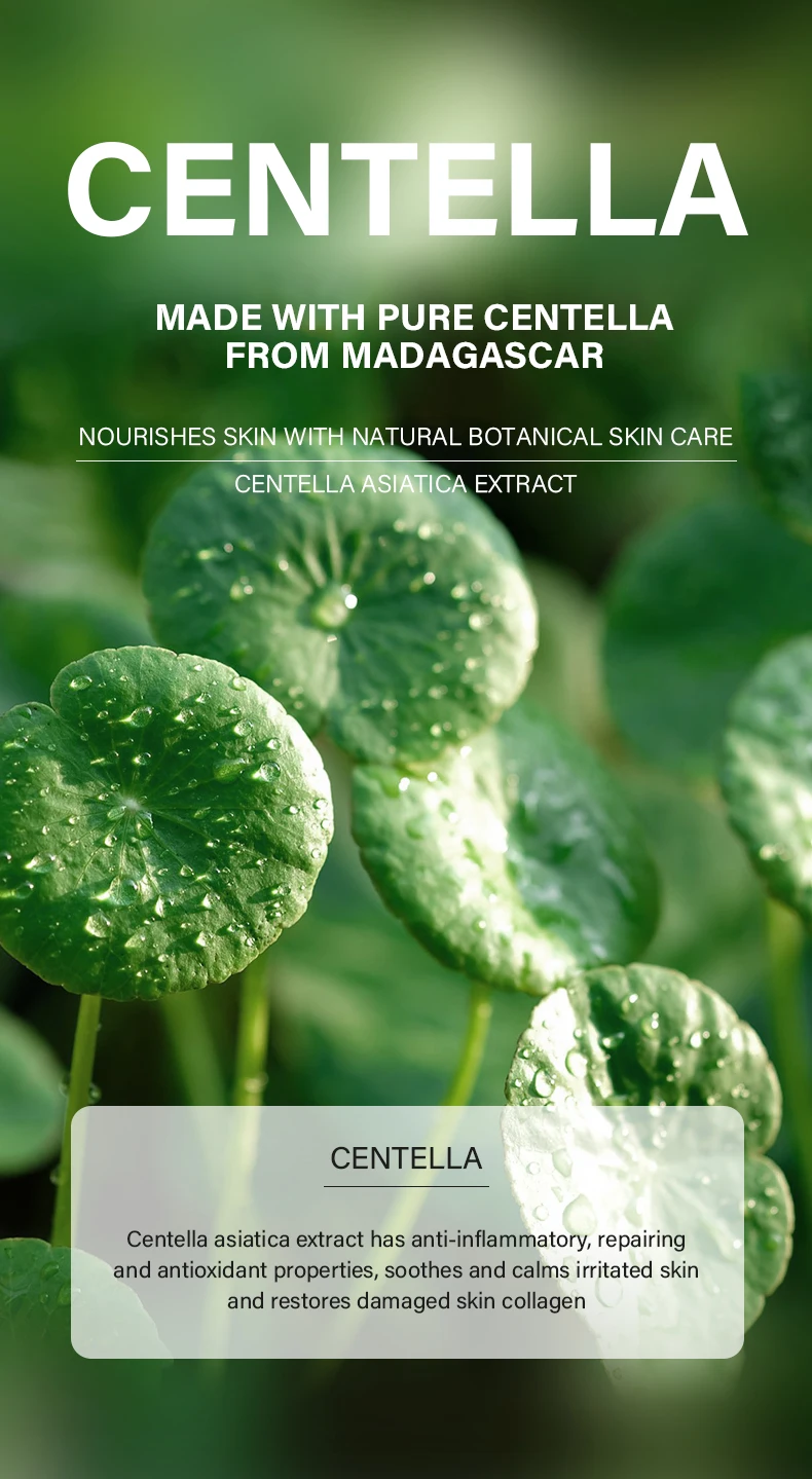 IREV Madagascar Centella Skin Care Set - Anti-Acne & Nourishing